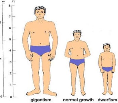 Dwarfism Definition